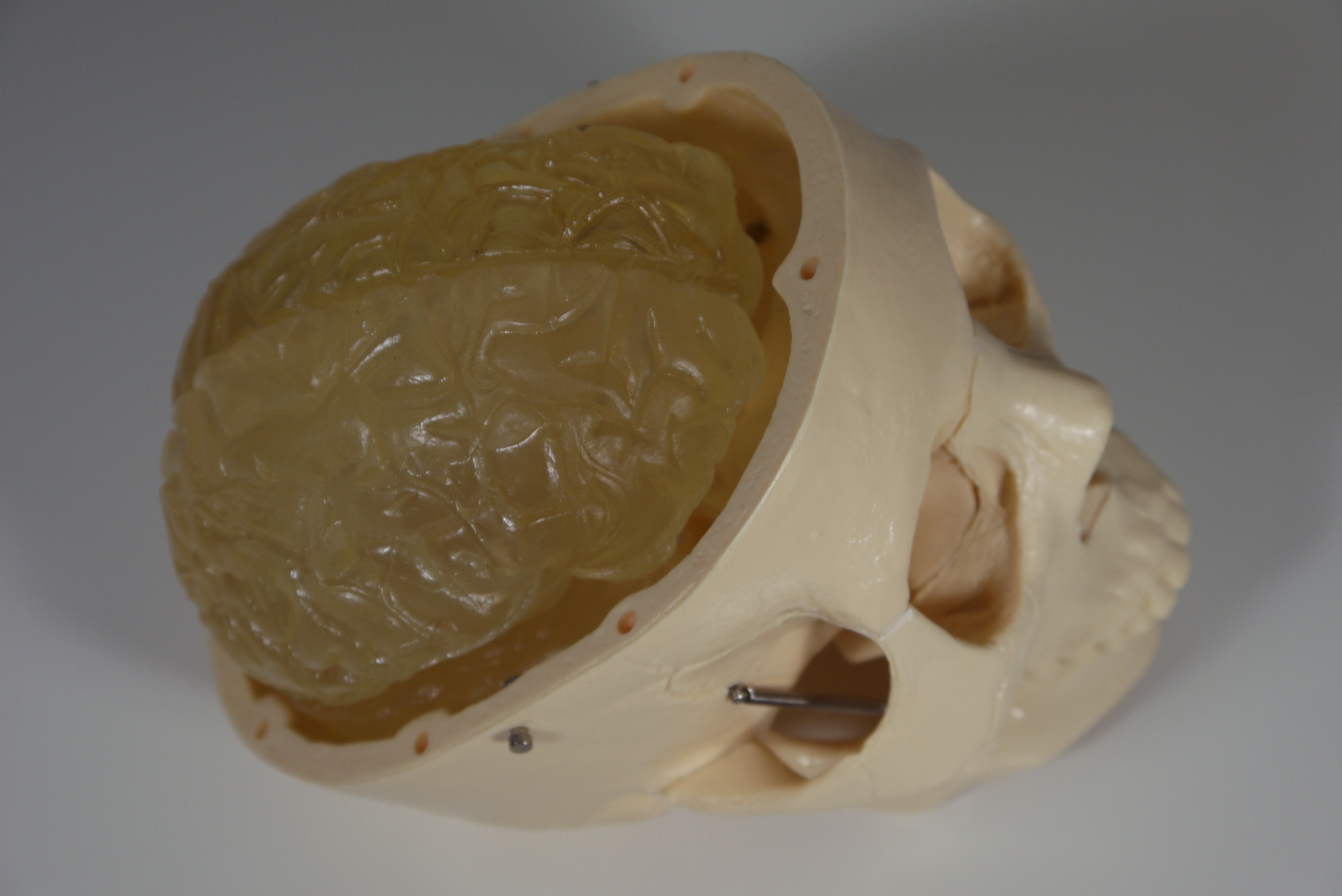Yorick, a Human Skull and Brain Teaching Aid for Cognition and Neuronarrative Related Lessons ...